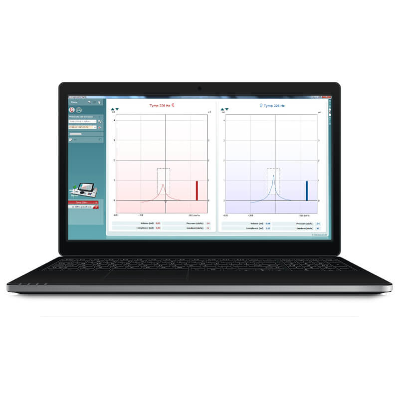 Interacoustics AT235