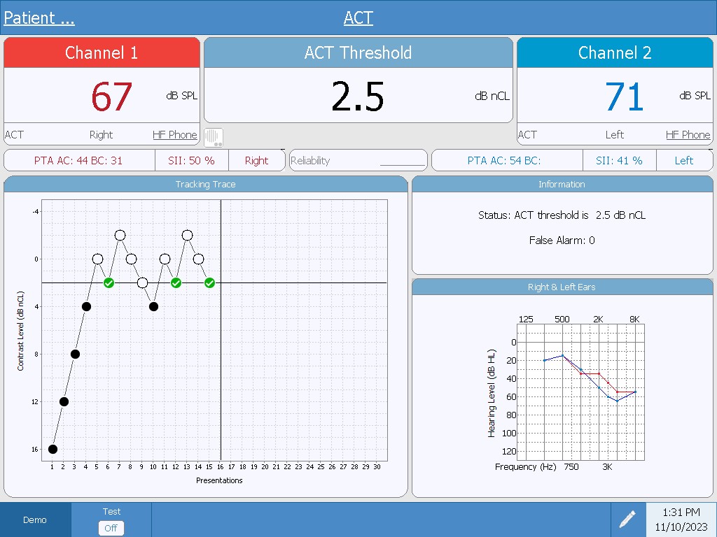 Audible Contrast Threshold (ACT™) for Grason Stadler