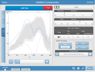 WideBand Example Tracings | GSI Blog