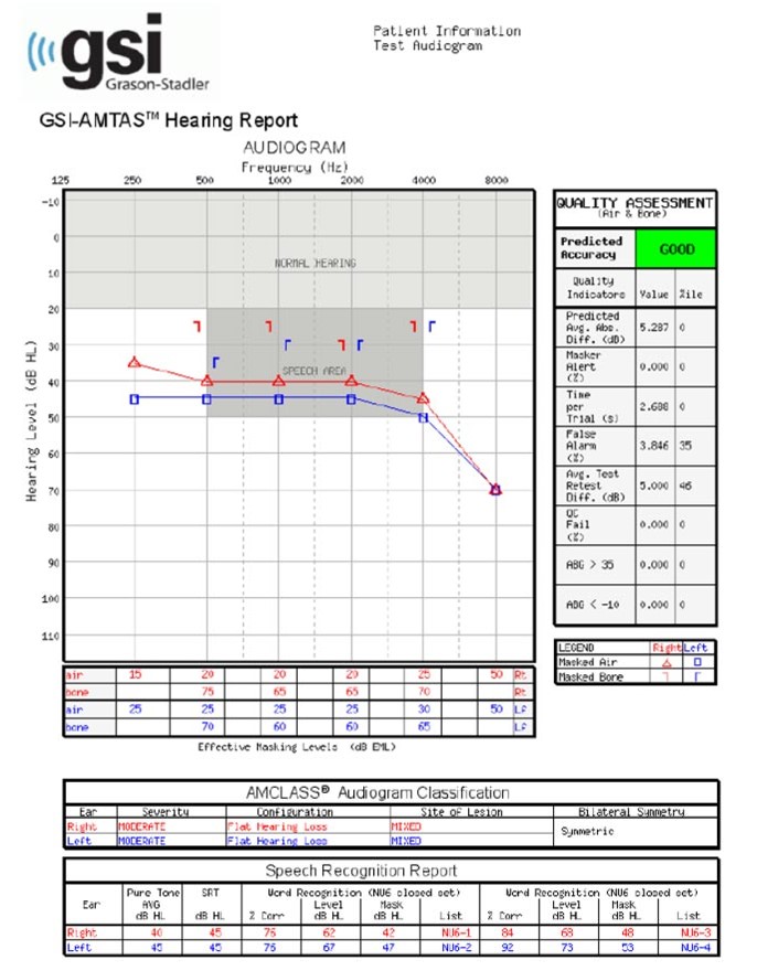 Automated Audiometry | GSI AMTAS Pro | Grason-Stadler