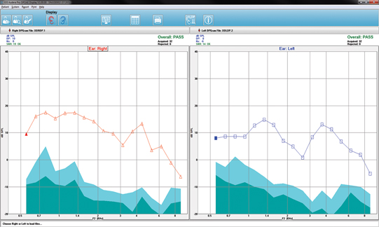 Clinical Evoked Potentials & OAE | Audera Pro | Grason-Stadler
