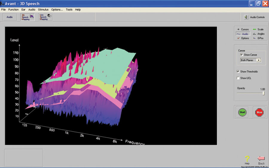 AVANT Software- Computer Based Audiometry Software | MEDRX