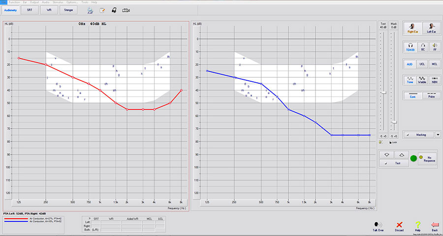 AVANT Software- Computer Based Audiometry Software | MEDRX