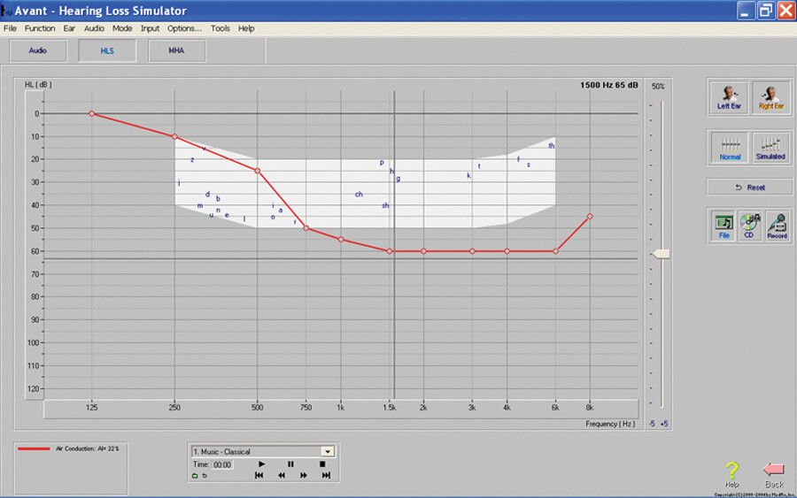 AVANT Software- Computer Based Audiometry Software | MEDRX