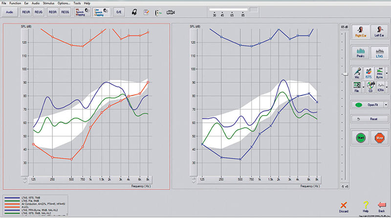 AVANT Software- Computer Based Audiometry Software | MEDRX