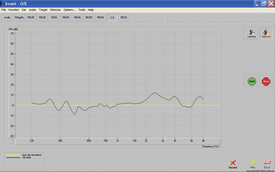 AVANT Software- Computer Based Audiometry Software | MEDRX