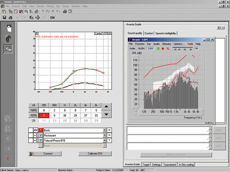 AVANT Software- Computer Based Audiometry Software | MEDRX