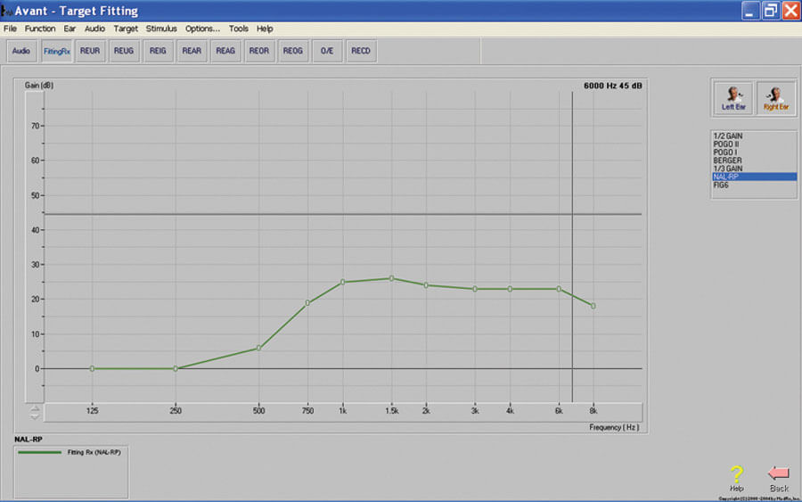 AVANT Software- Computer Based Audiometry Software | MEDRX