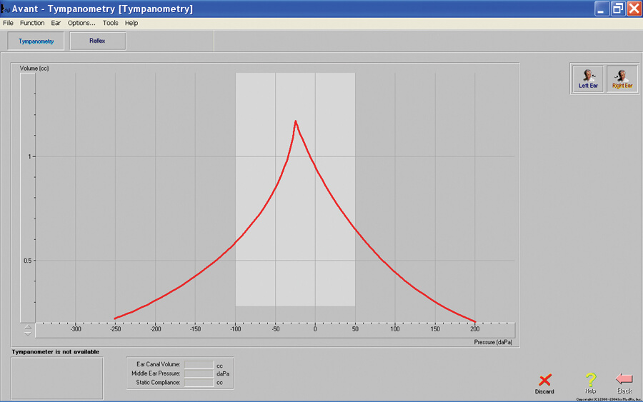 AVANT Software- Computer Based Audiometry Software | MEDRX