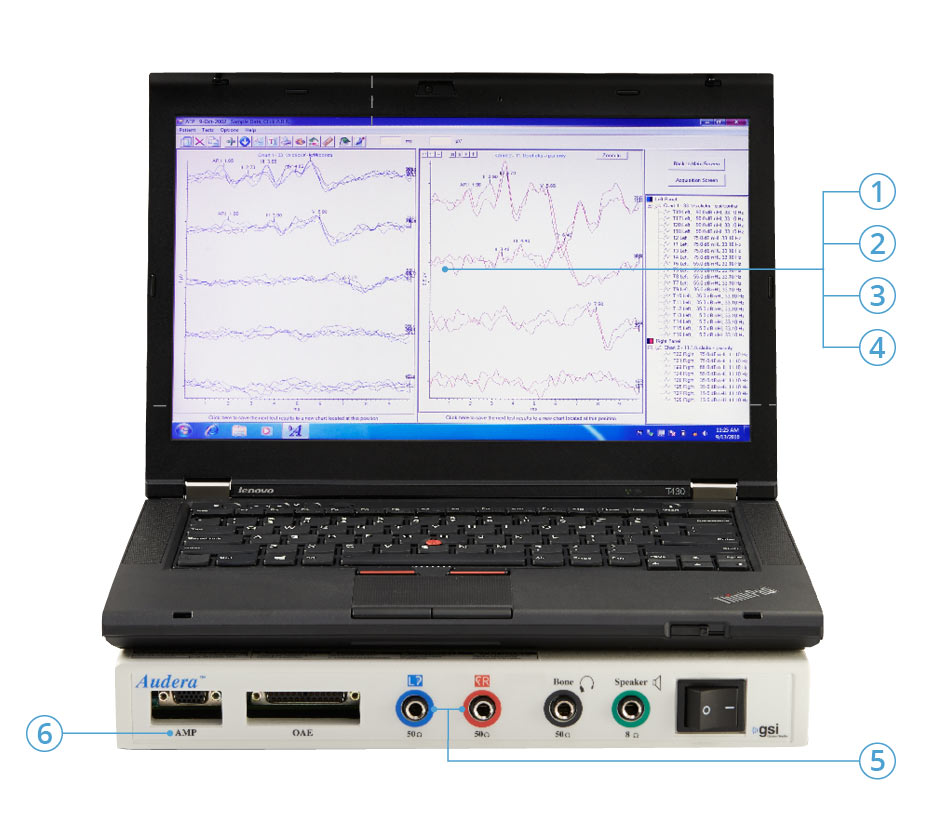 Potentiels évoqués auditifs | GSI Audera™